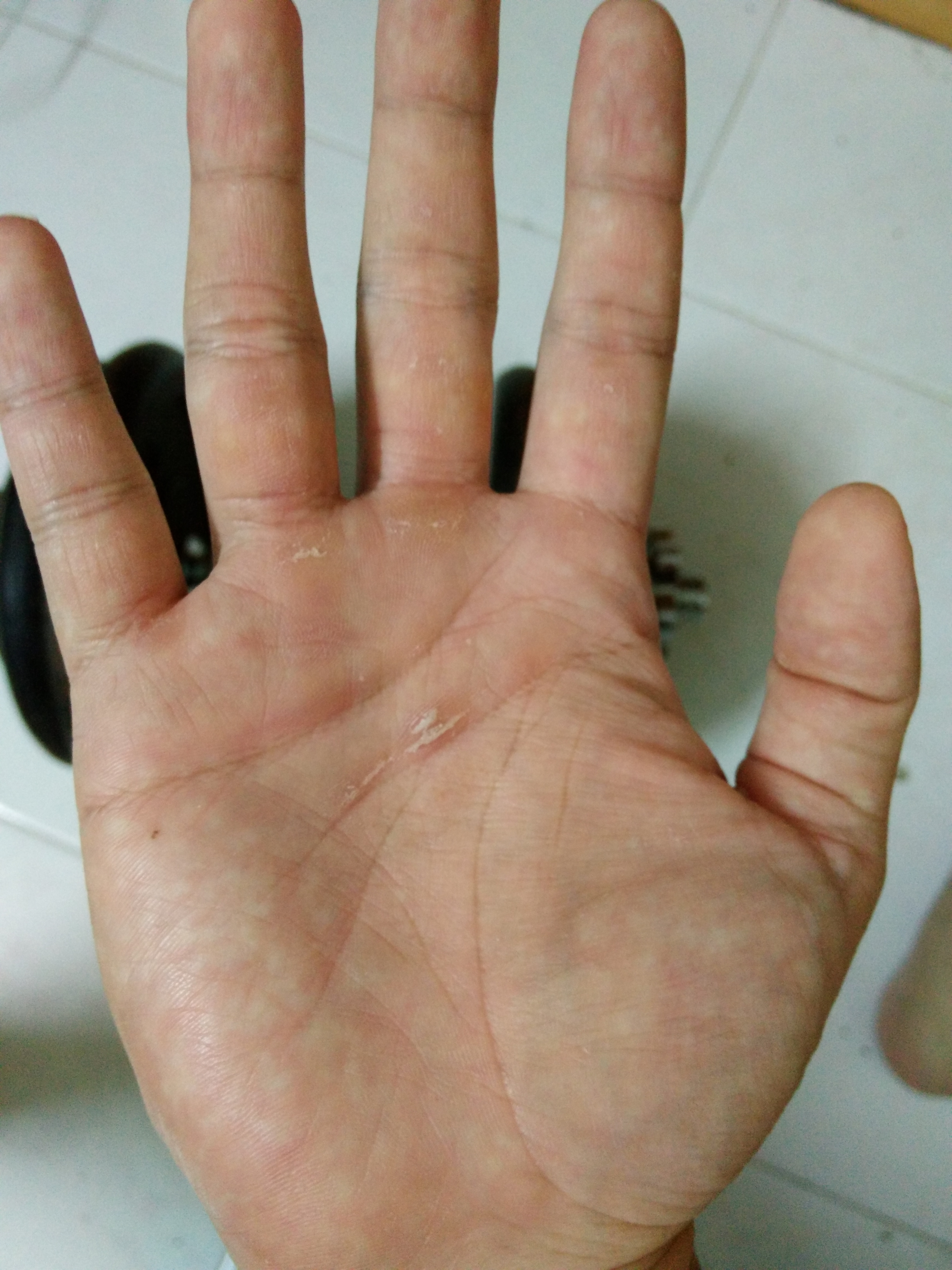 [GPGT]Smaller Dumb bell handle giving abrasion.... | HardwareZone Forums